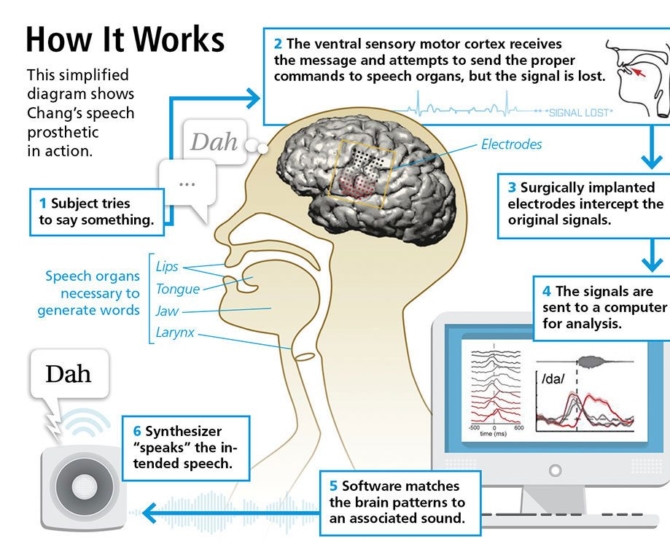 #MindControl: Translating Brain Signals to a Voice Synthesizer | Emerj ...
