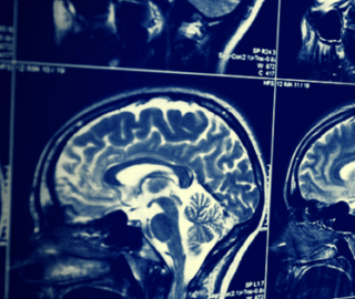 Deep Learning Applications in Medical Imaging | Emerj Artificial ...