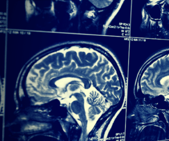 Deep Learning Applications in Medical Imaging | Emerj Artificial ...