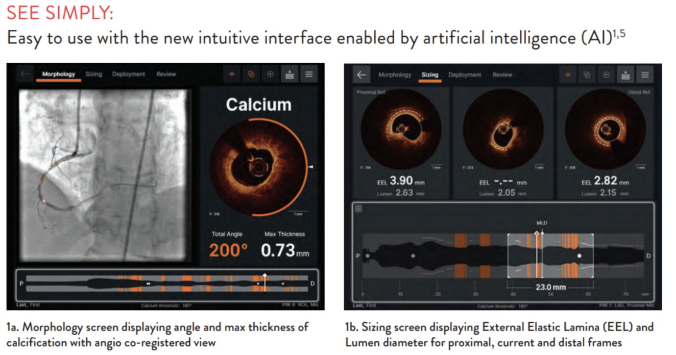 Artificial Intelligence at Abbott - Two Current Use-Cases - Emerj ...